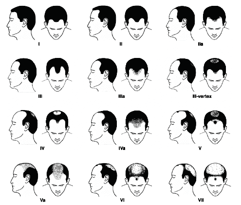 The Science of Laser Therapy - Biolight Medical Hair Therapy